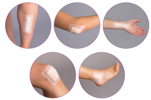 10 Types Of Wound Dressings And When To Use Each Of Them