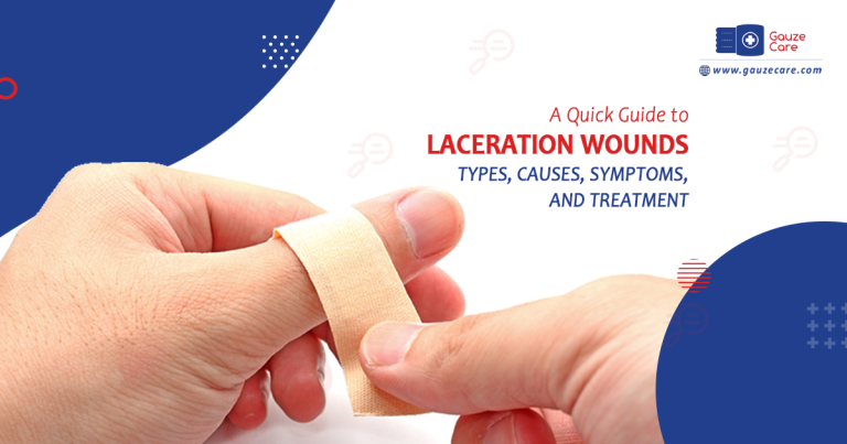 Quick Guide To Laceration Wounds: Causes, Types & Treatment