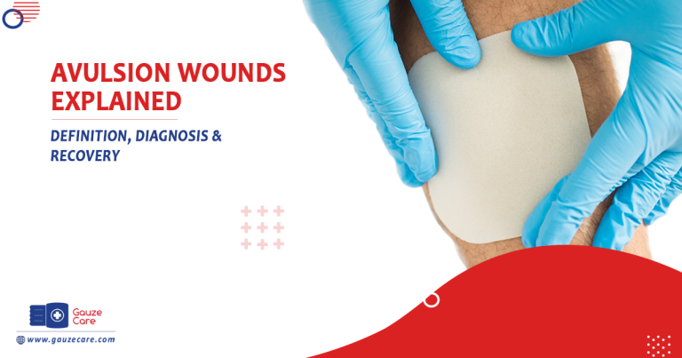 Quick Guide To Avulsion Wounds: Diagnosis & Recovery