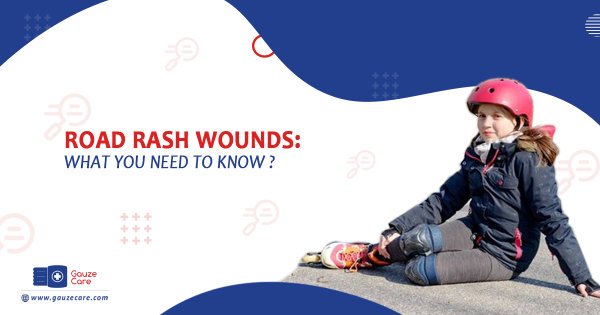 Road Rash Wounds: How To Treat Them Safely?